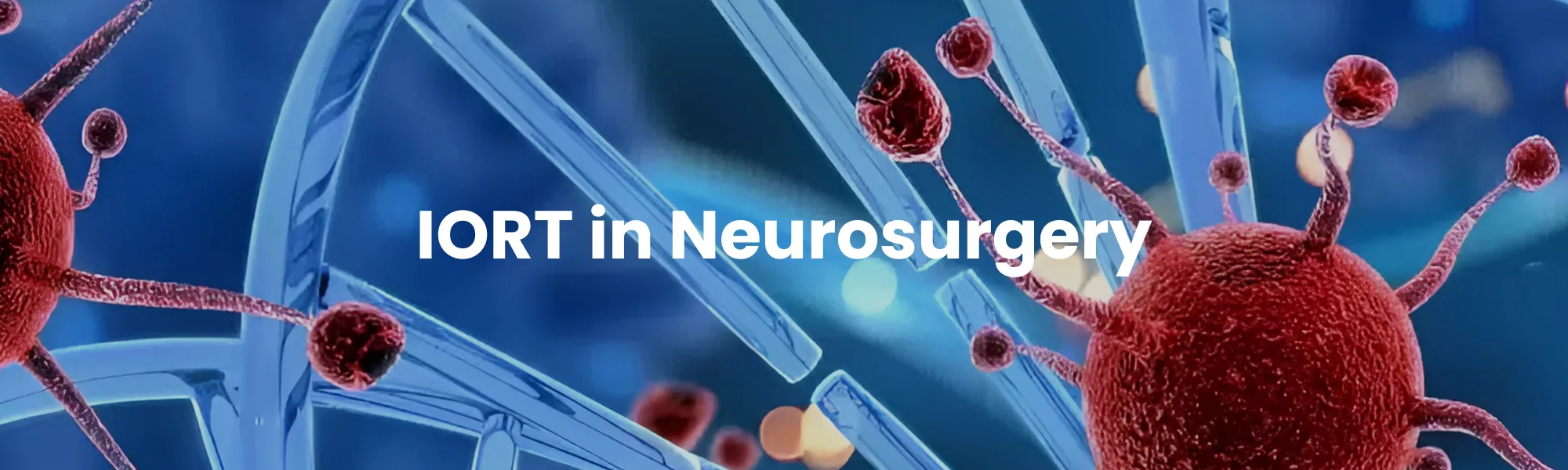 Redefining Brain Tumour Care with IORT